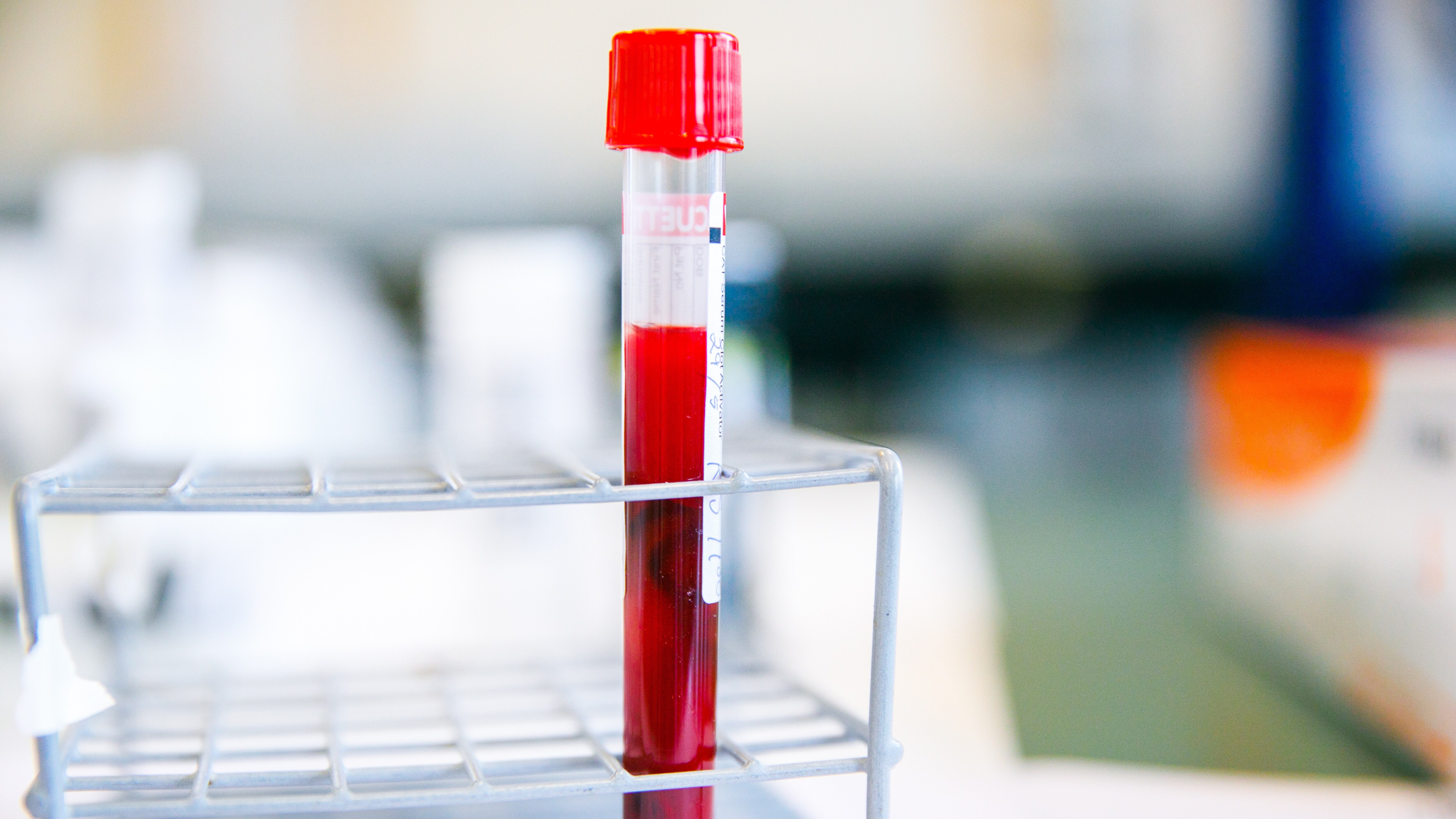 VG Nyheter: Tredoblet coronasmitte i Oslo - VGTV